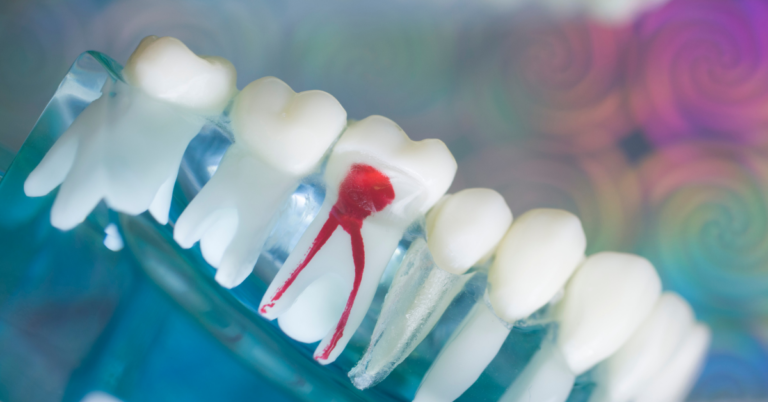 Bruise on Gums - Causes, Symptoms and Treatments! | Exercise Daily